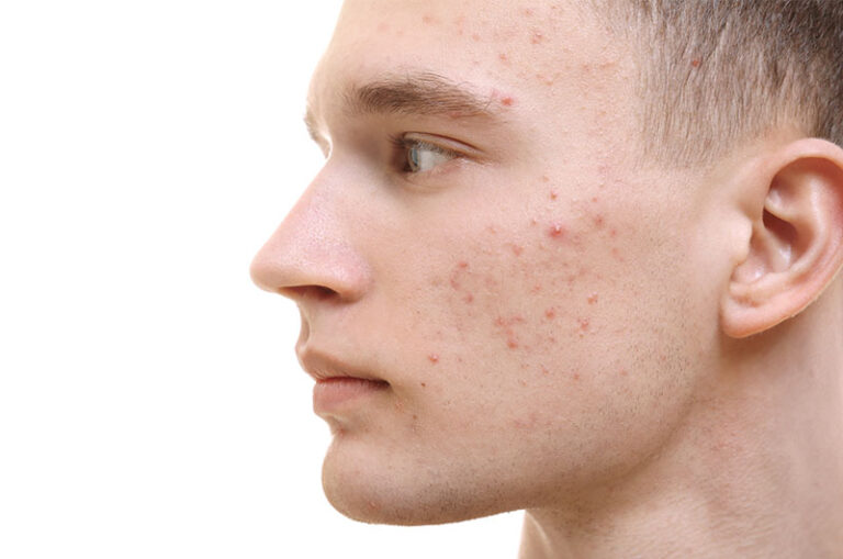 General Skin Conditions | Appearance Medical Centre