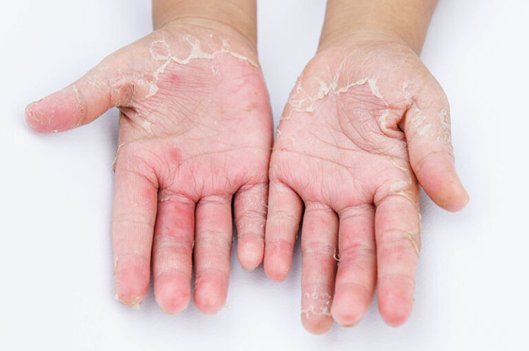 General Skin Conditions | Appearance Medical Centre